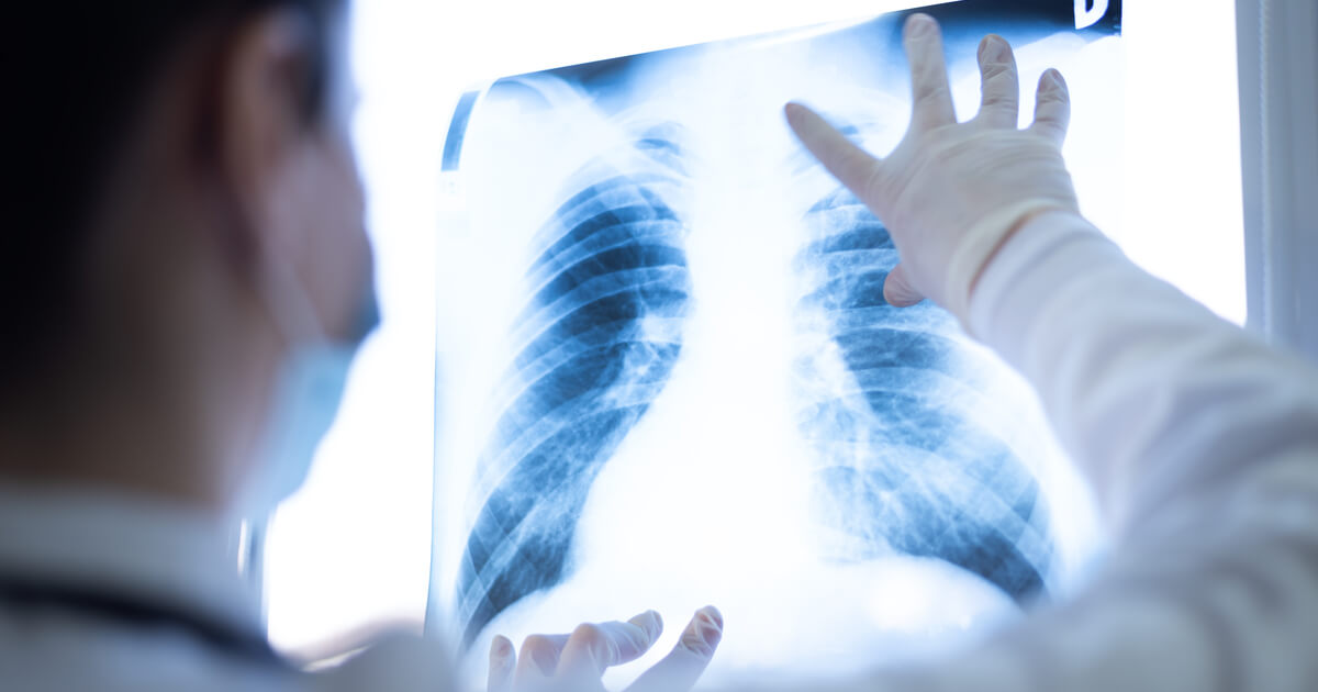 1.7 Million Workers Suffer Work-Related Illness in 2020/21